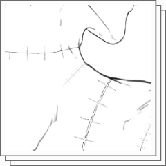 Stitch wounds - CLIP STUDIO ASSETS